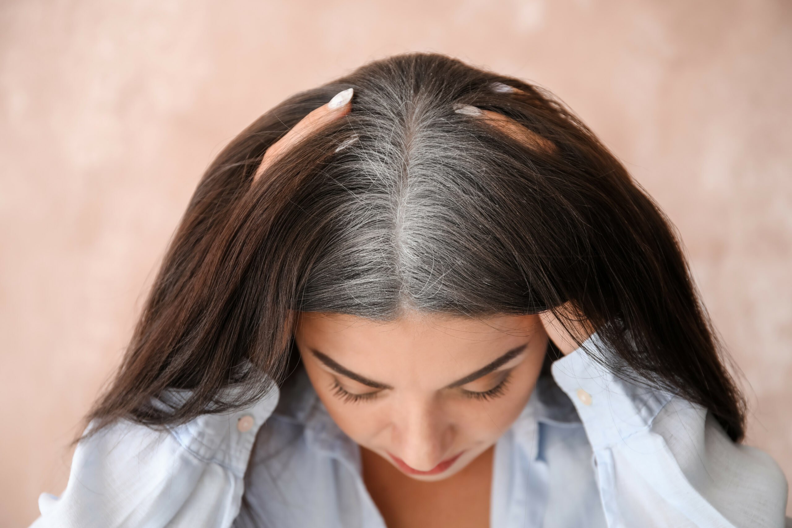 Tumbuh Uban pada Usia Muda? Coba Terapkan 3 Hal Ini