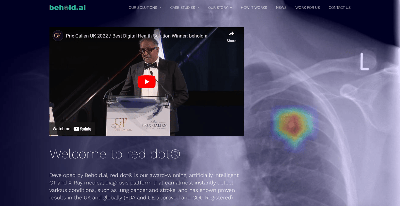 Recent Update and Overview of Behold.ai - for 2025