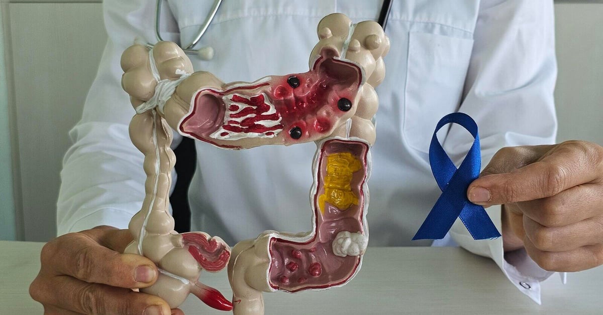 Understanding Colorectal Cancer Signs: What to Look Out For - Heartino