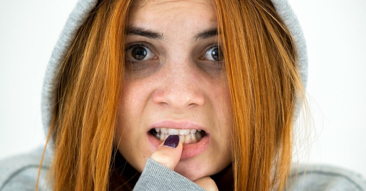 Understanding missing teeth: Causes, effects, and solutions - ExplorEverity