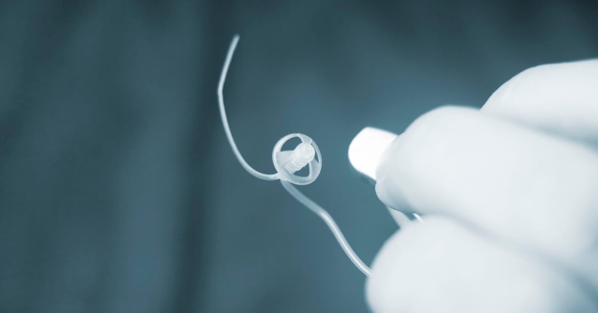 Understanding sperm donation: A comprehensive guide - ExplorEverity