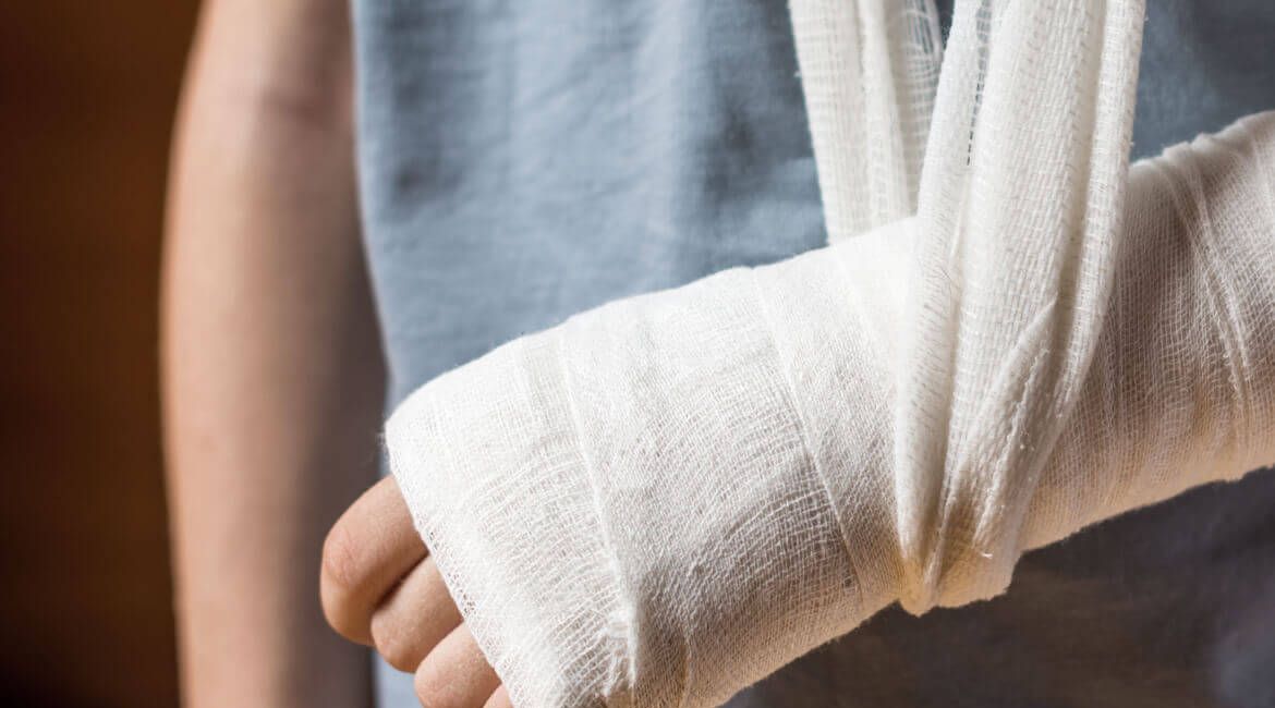 Arm Injury Claims | How Much Compensation Can I Claim?