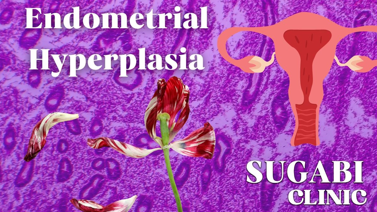 Endometrial Hyperplasia: Symptoms, Diagnosis, Treatment.