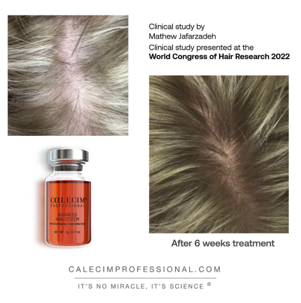 Special Hair Treatment Course | TDC Beauty and ...