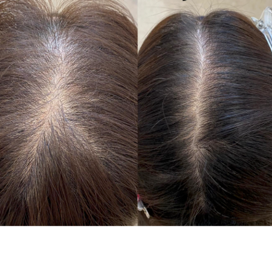 Special Hair Treatment Course | TDC Beauty and ...