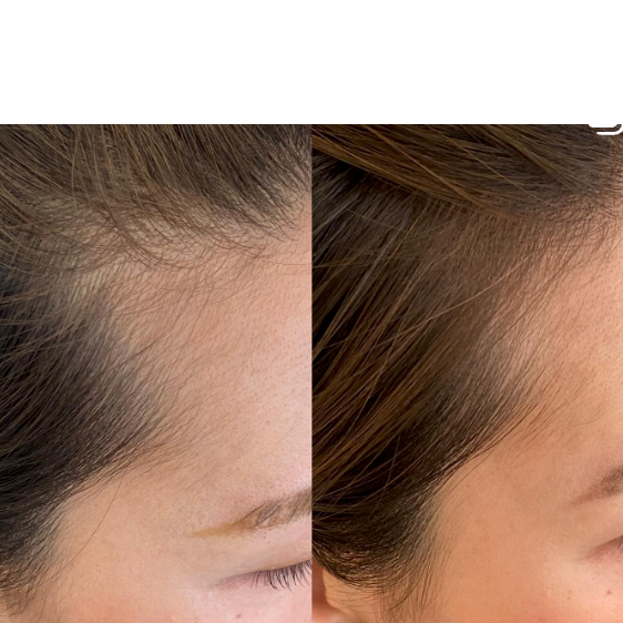 Special Hair Treatment Course | TDC Beauty and ...