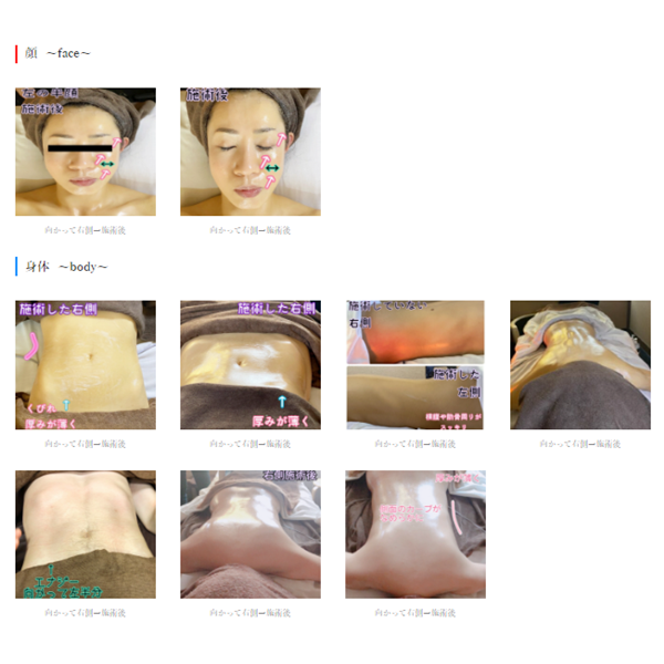KBフィンガーEビューティー -KB Finger E Beauty- | プロ用美容 KBフィンガーEビューティー -KB Finger E Beauty- | プロ用美容