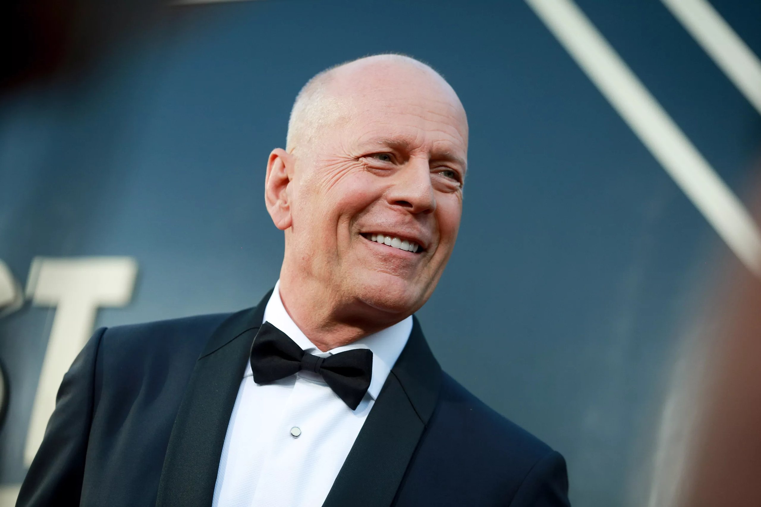 Bruce Willis enfrenta estágio severo de demência e já não consegue ...