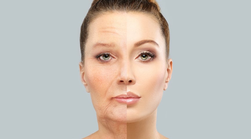 The Secret of Human Wrinkles: How They Form, and Why They Might be ...