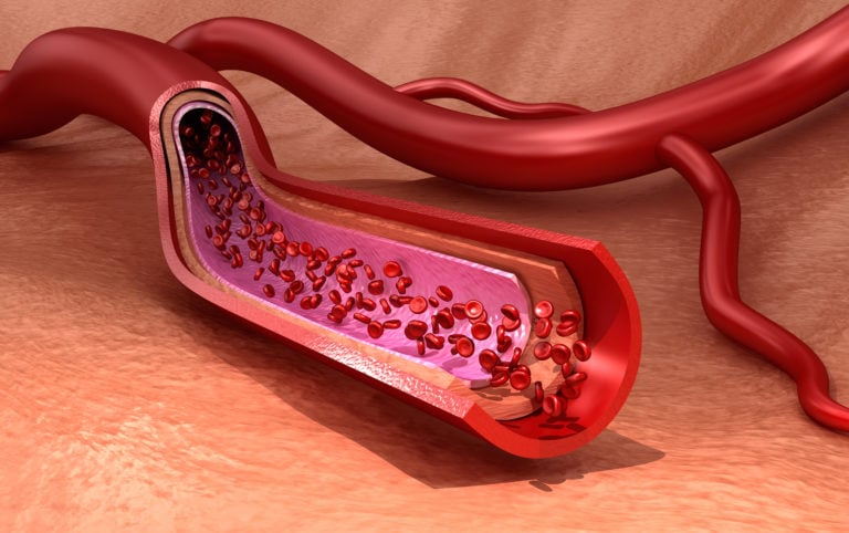Defibrotide Shows Broad Promise in Managing Endothelial Injury Across ...