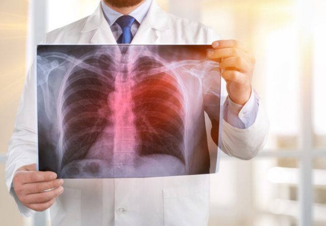 FDA Approves Nabriva’s Xenleta (lefamulin) for Community-Acquired ...