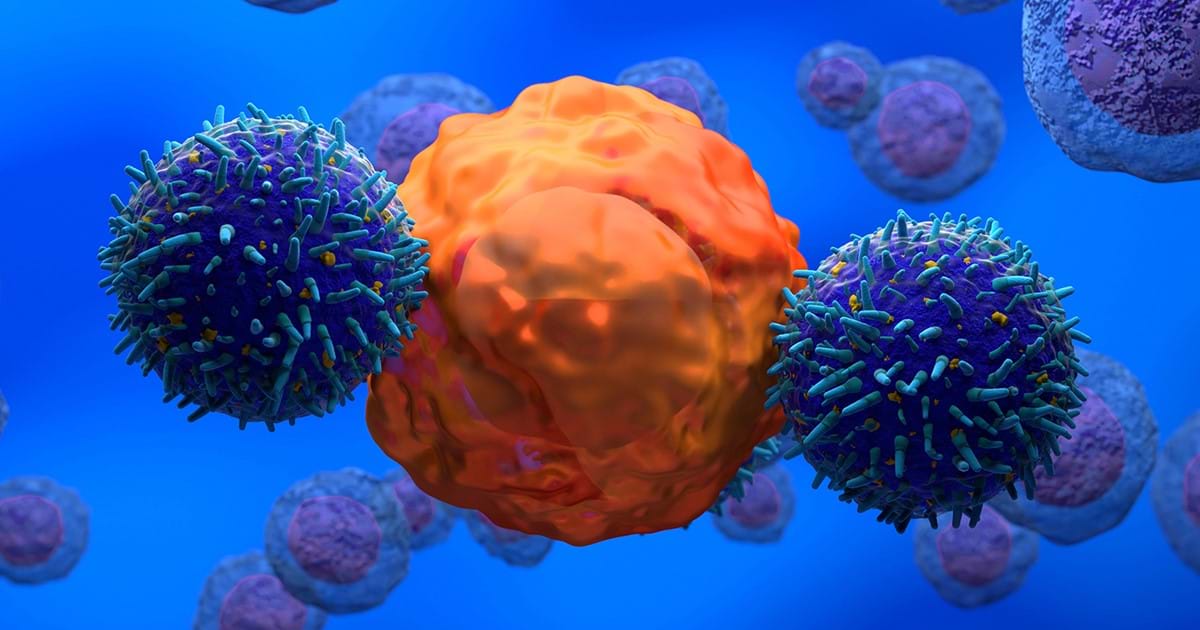 CAR T Therapy Shows Dramatic Impact in AL Amyloidosis