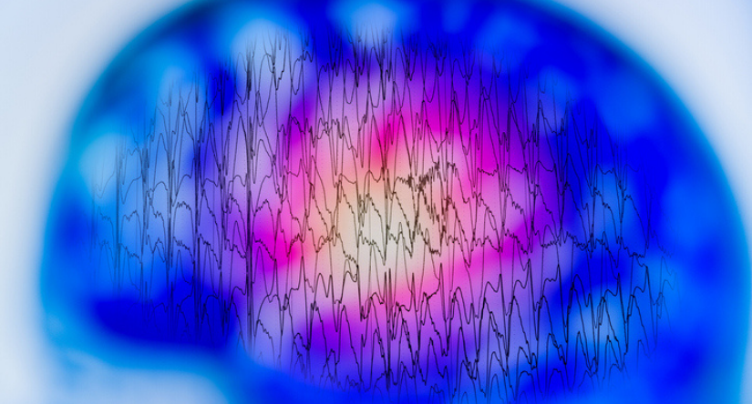 Stoke Therapeutics Reports Antisense Drug STK-001 Shows Early Signs of ...