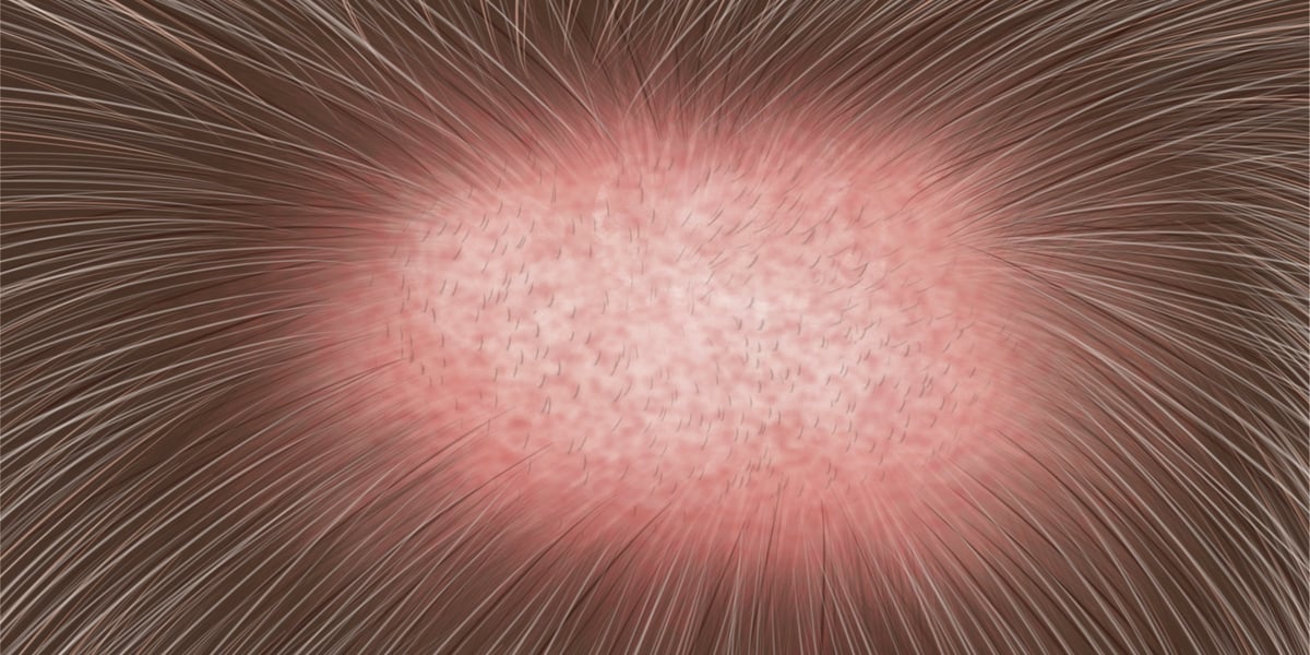 Waggel Blog - Ringworm in Cats - Treatment and Symptoms