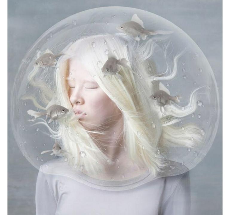 Abandoned as a baby in China because of the way she looked, this Albino ...