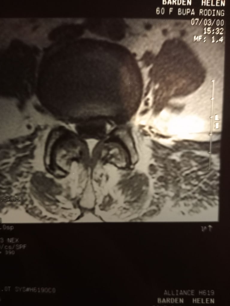 MRI x-rays fancy dress doctor costume nurse costume medical xray role ...