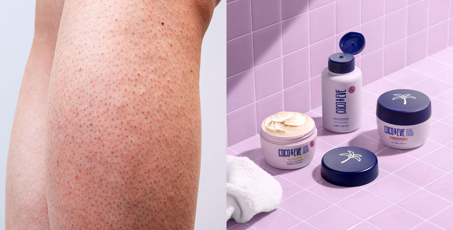 Banish Strawberry Legs: Proven Remedies with Coco & Eve | Coco & Eve