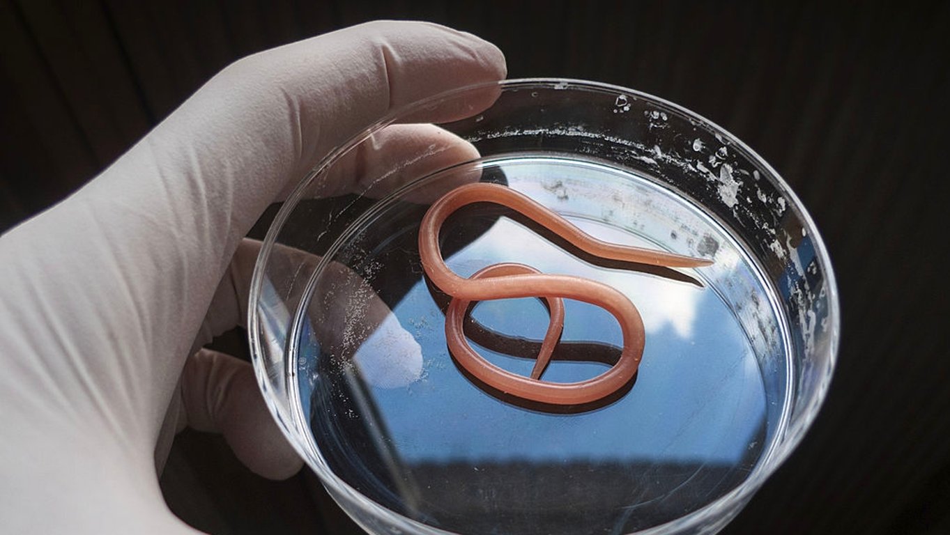 Parazity můžete mít v těle roky bez příznaků. Když se projeví, bývá ...