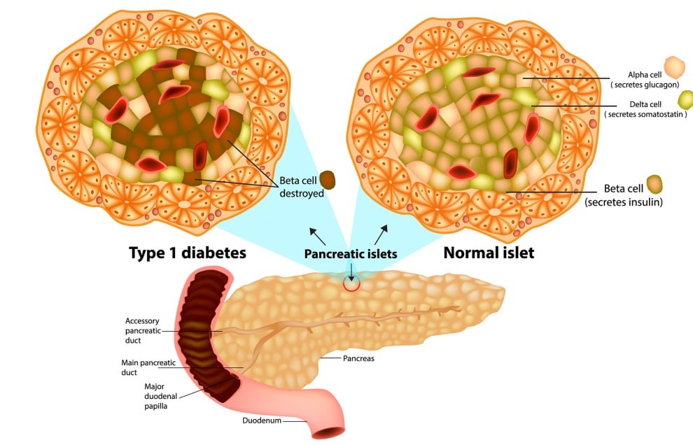 A Natural Solution for Pancreas Health and Pancreatitis Treatment ...