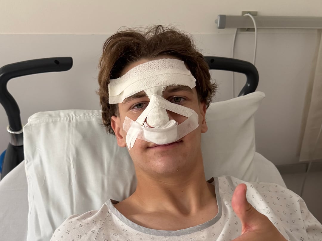Cagnotte : Réparer se jolie nez | Leetchi