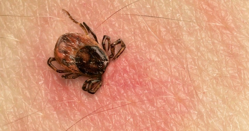 Here's what you need to know about tick season