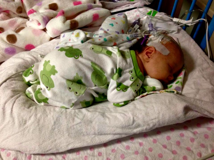 Rare Birth Defect Appears in Babies of 3 Women Living on the Same Street