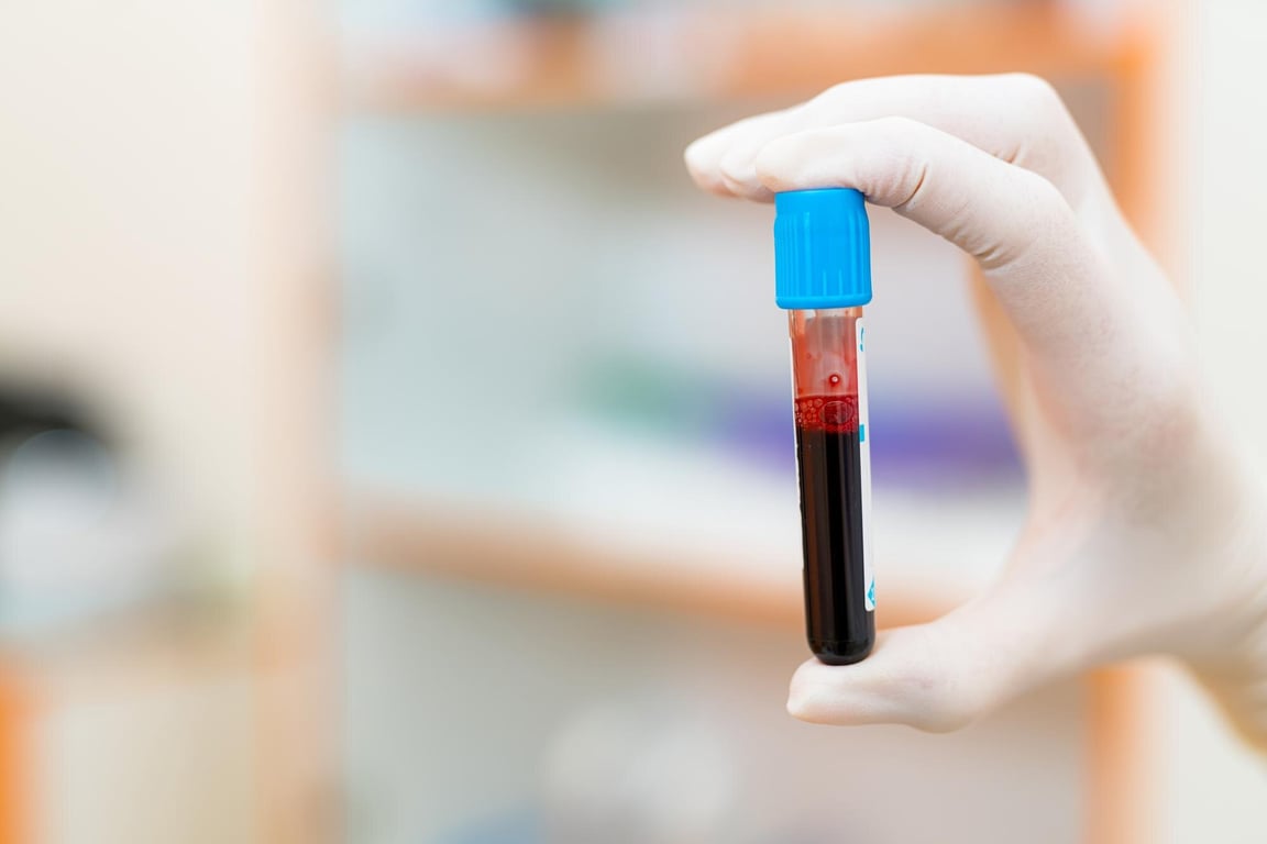 How To Become A Phlebotomy Instructor in 2025