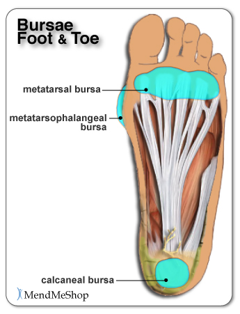 Intertarsal Intermetatarsal Bursitis, Mistaken For Morton's Neuroma