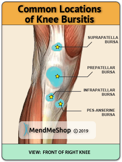 Lateral Bursitis Knee Knee Pain Symptom Checker [Online Knee Injury