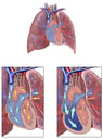 Normal Lung vs. Emphysemic Lung : Medical Illustration