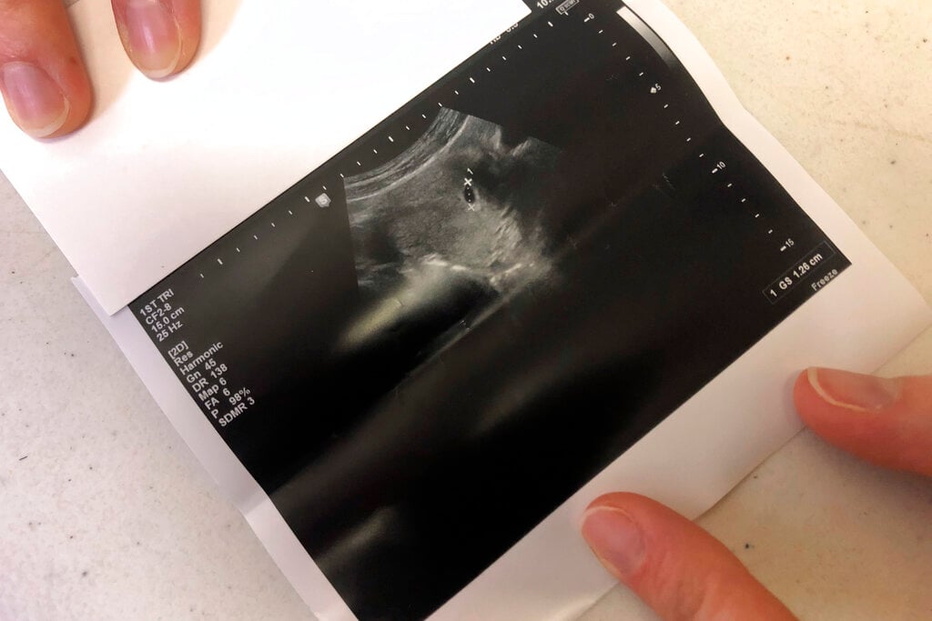 Embryos as property, not kids | Courthouse News Service