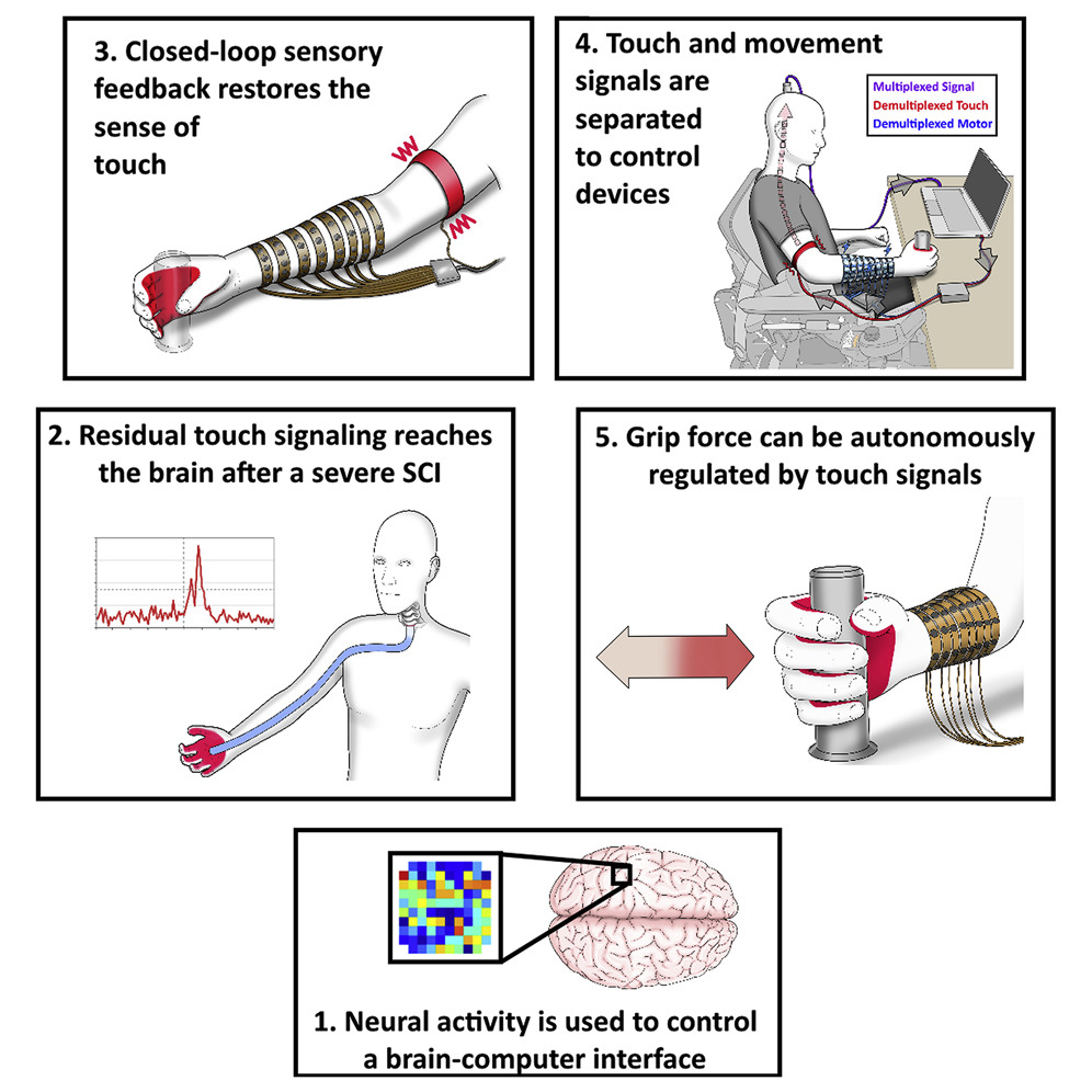 Sense of Touch Restored After Spinal Injury Using Brain-Interface ...