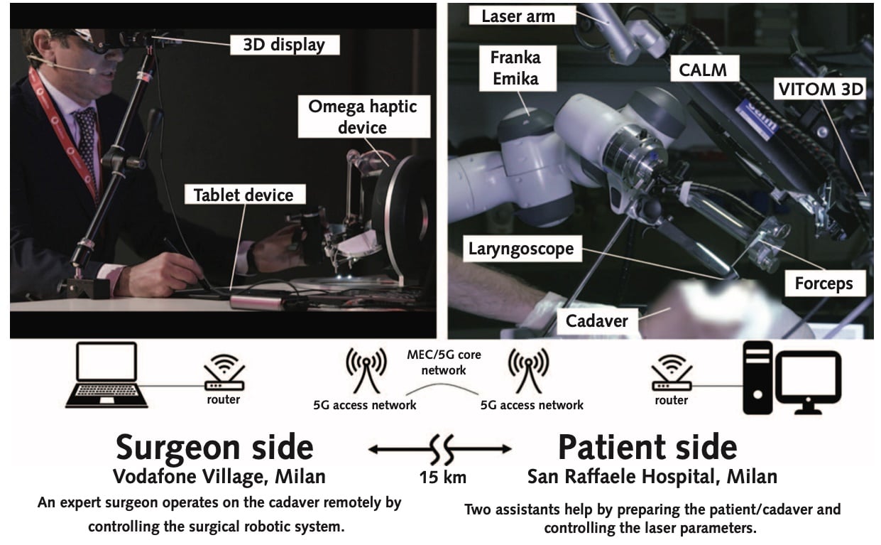 Socially Distant Surgery: Doctor Uses 5G to Perform Remote Operation ...