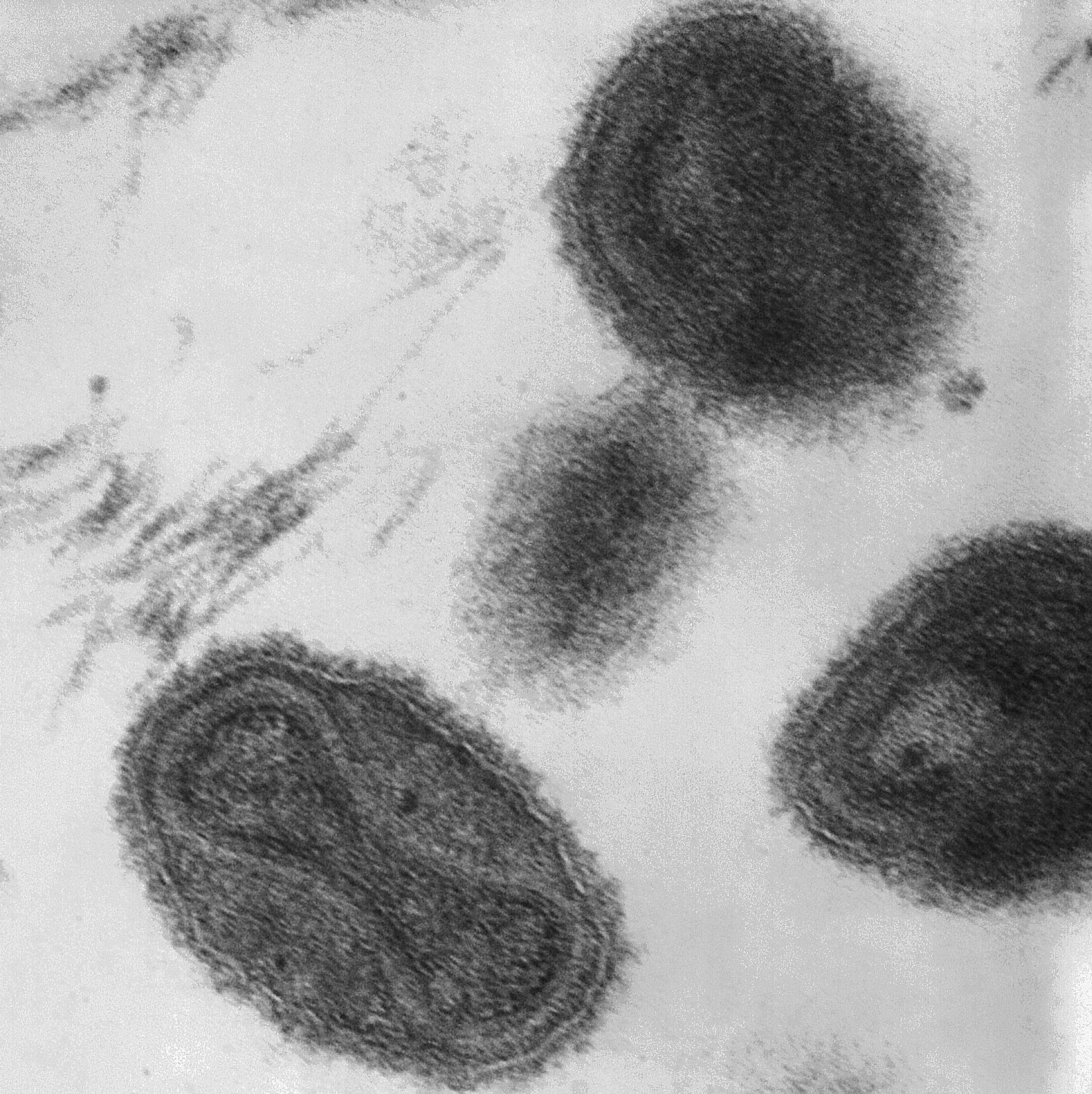 Three Centuries of Smallpox Records Offer Insights on Progression of ...