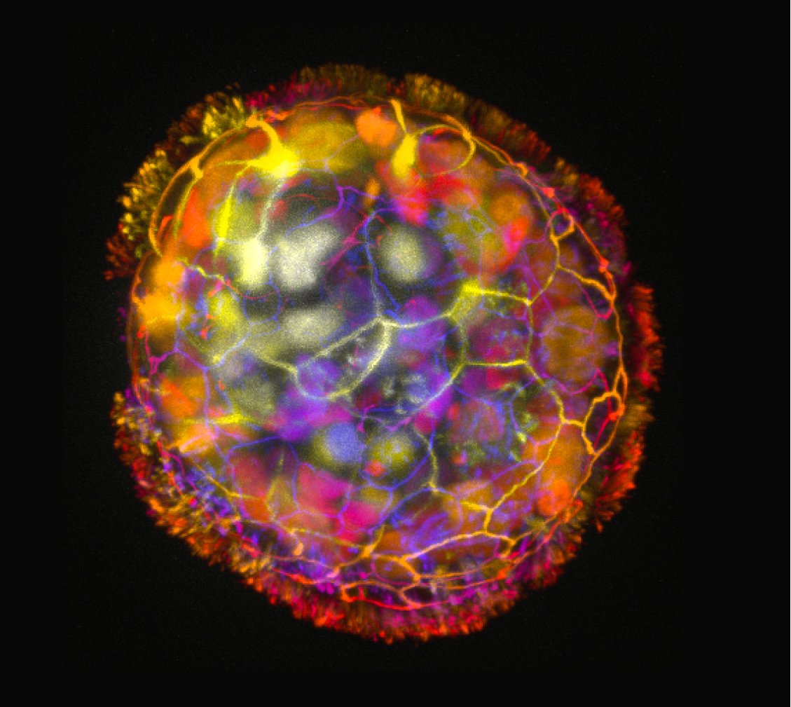 Scientists develop biobots from human cells to repair damaged neurons ...
