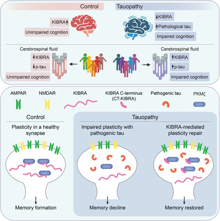 Brain and kidney protein could restore memories taken by Alzheimer's ...